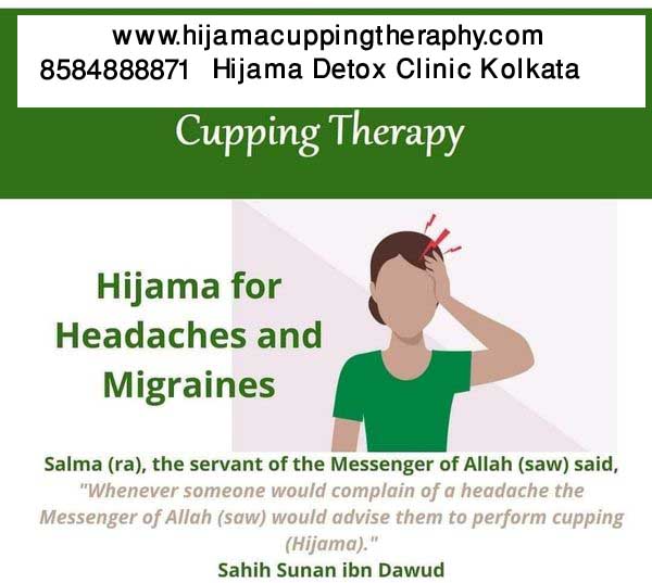 HIJAMA FOR MIGRAINE HEADACHES. Hijama Cupping Detox Therapy Clinic ...
