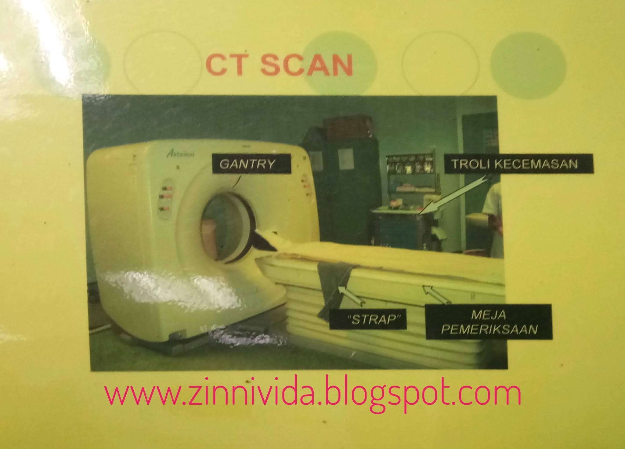 CT Scan (TAP)