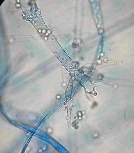 ATLAS MICOLOGIA: SYNCEPHALASTRUM RACEMOSUM