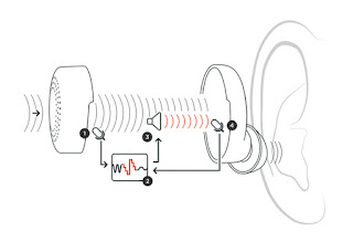 What this kind of thing like ? to hear the Bionic Ear | MagOne 2016