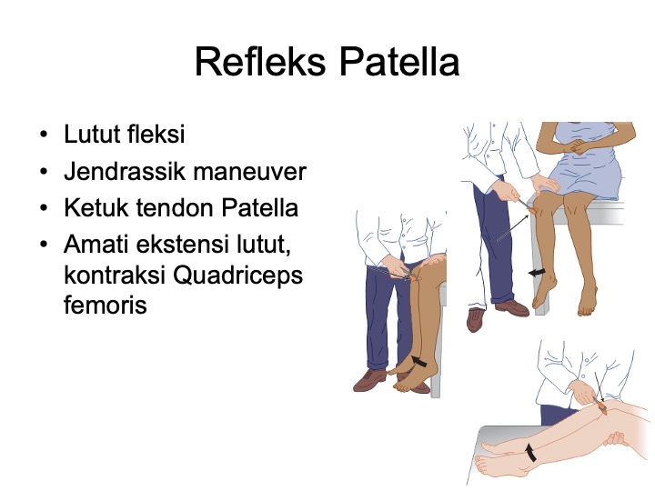 Pemeriksaan Refleks: FK semester 1