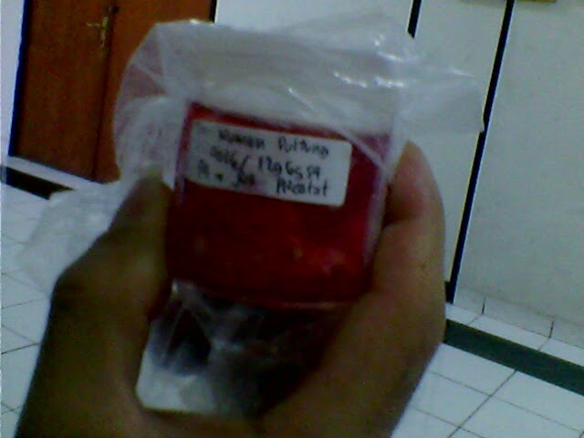 Hasil Operasi Prostat - Homecare24