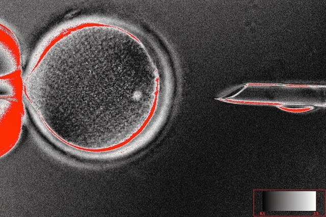 Stem cells cloned first time from a man's skin « Science Center