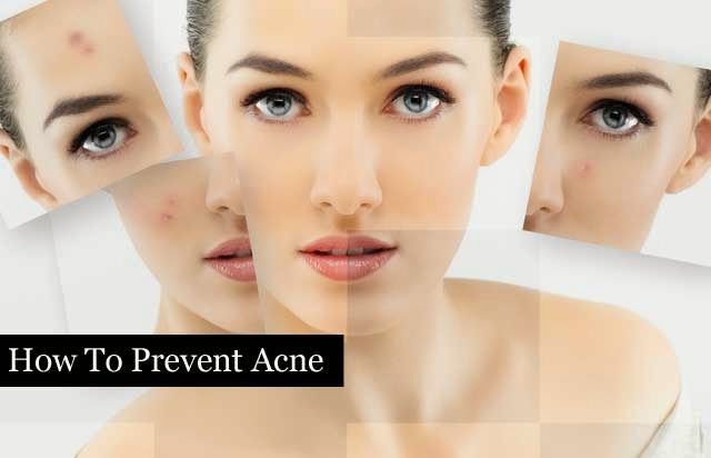 How to prevent and get rid of acne scars | Best acne treatment