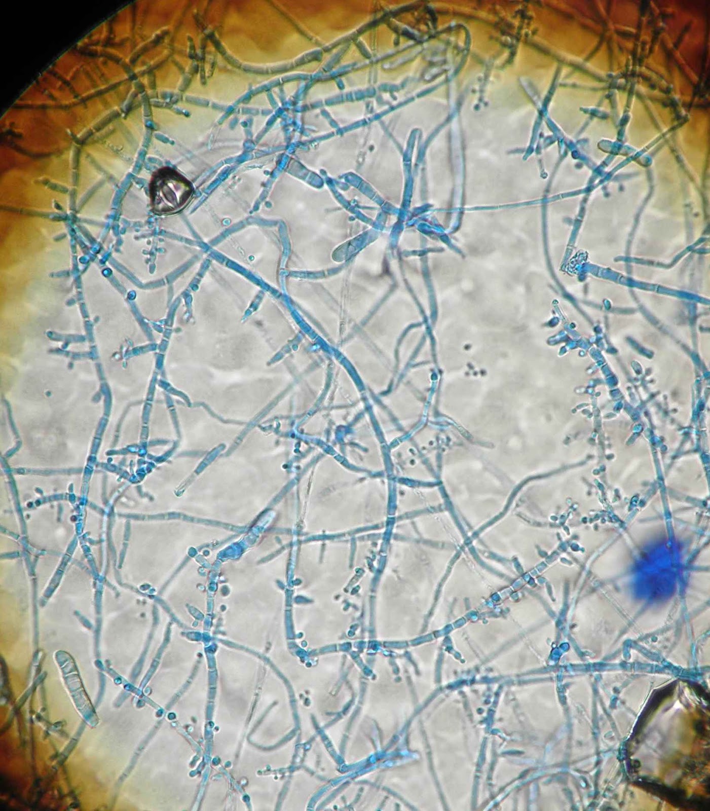 ATLAS MICOLOGIA: TRICHOPHYTON INTERDIGITALE
