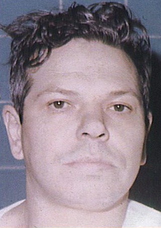 Facie cianotica .- Color azulado en mejillas y nariz