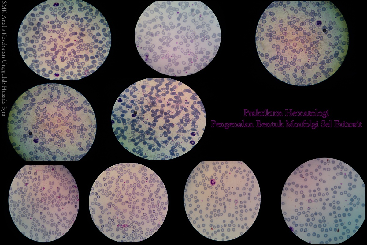 Pengenalan Morfologi Sel Erytrosit | Analis Kesehatan