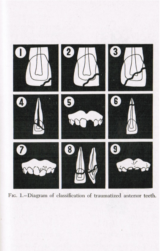 The Classification and Treatment of Injuries to the Teeth of Children ...