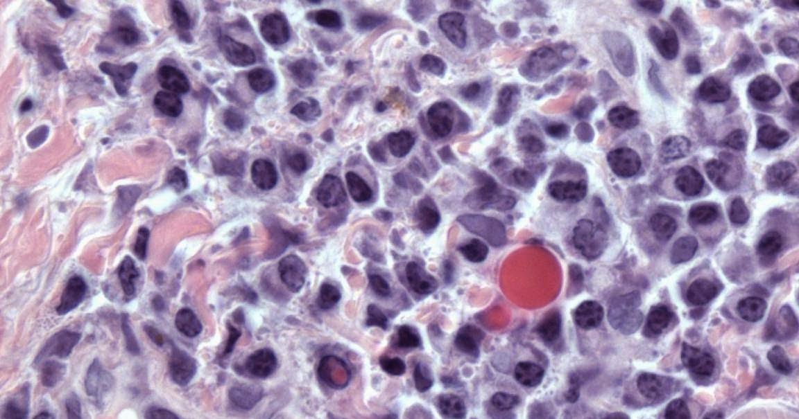 Lisosomas, peroxisomas y vacuolas - Biología
