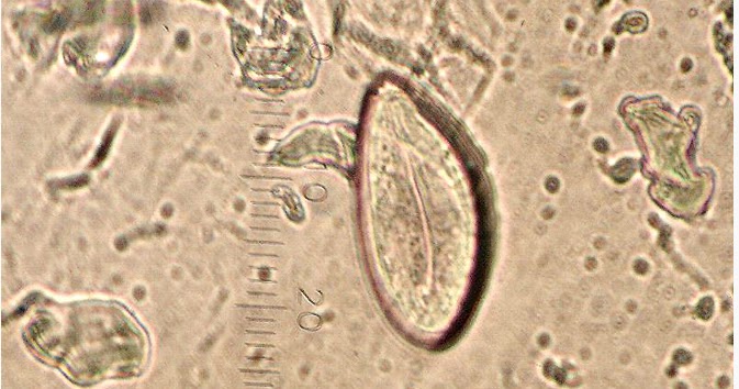 Enterobíase ou Oxiuríase - Enterobius vermicularis | Eu Quero Biologia