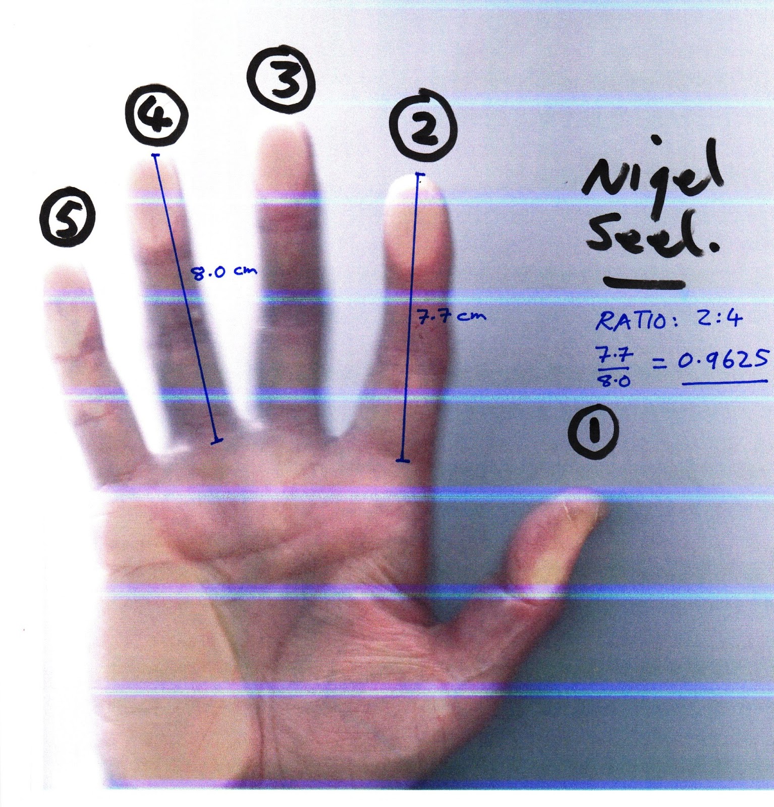 Wading Through Treacle: Digit ratios