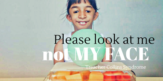 PLEASE LOOK AT ME, NOT MY FACE! - Story Of My Life