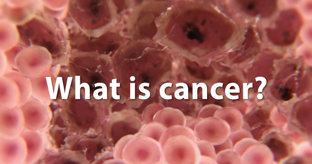 Cancer :- Basic Concepts