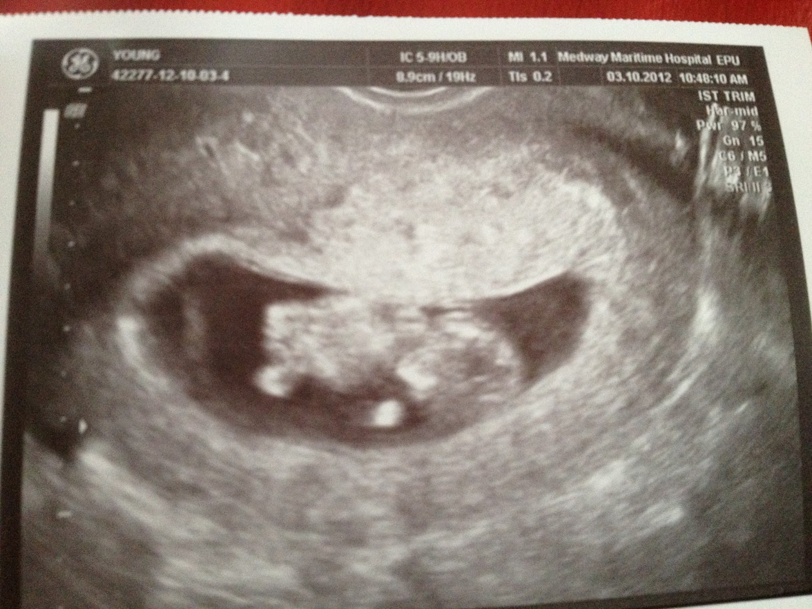 A Mothers Love: Waiting for my little girl