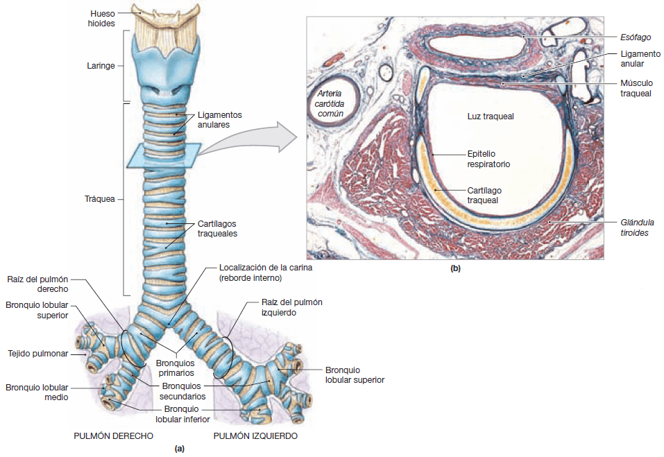 Bronquios De Paredes Espessadas
