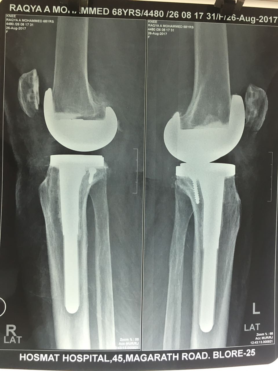 Dr. Rajashekar K T - Best Joint, Hip and Knee Replacement Surgeon in ...