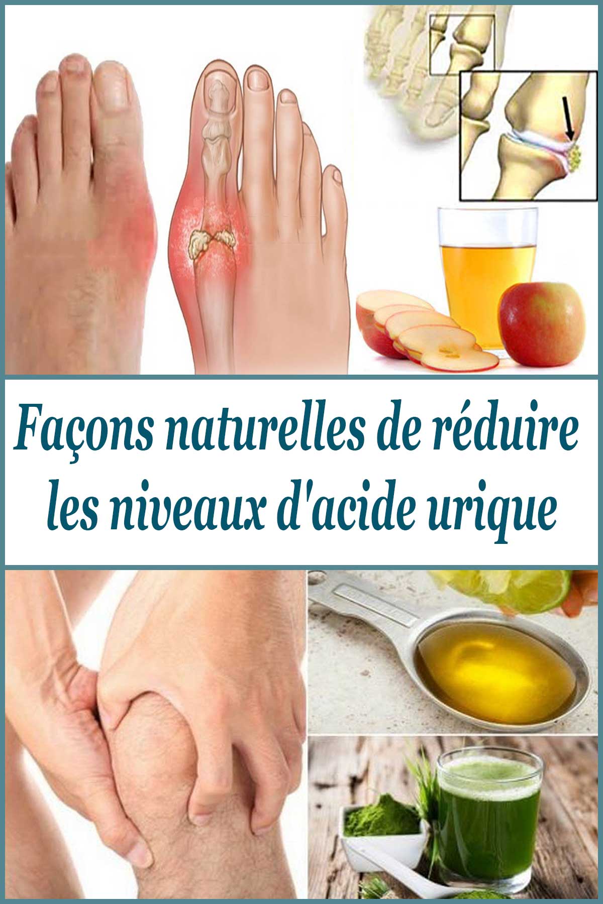 10 Façons naturelles de réduire les niveaux d'acide urique ~ Remèdes Maison
