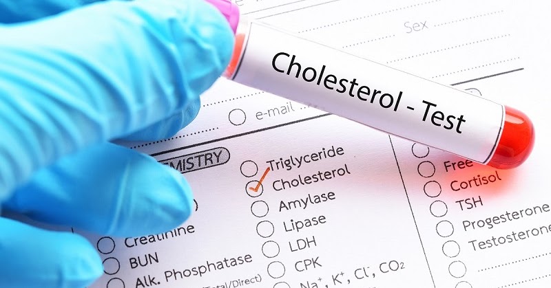 Cholesterol Test- Things You Have to Know About