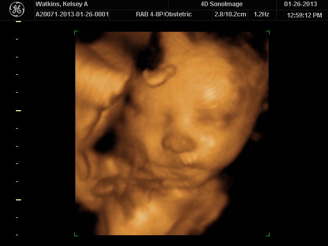 Hello, Bebe Watkins!: 4D Ultrasound | 31 Weeks