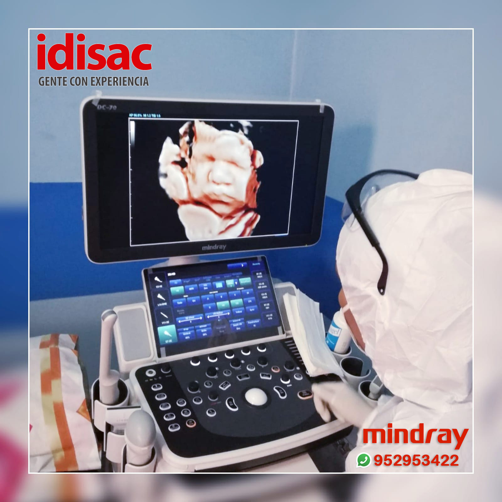 ECOGRAFOS MINDRAY PERU - Venta de Equipos Medicos - IDISAC idisac ...
