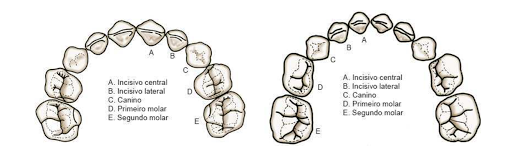 TUDO SOBRE PRIMEIRO E SEGUNDO MOLAR DECÍDUO SUPERIOR