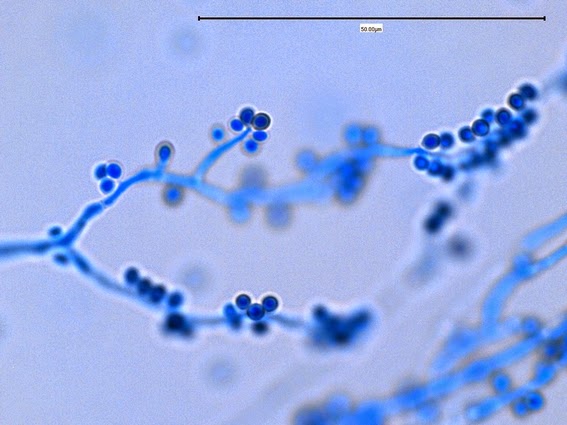 Fun With Microbiology (What's Buggin' You?): Sporothrix schenckii ...