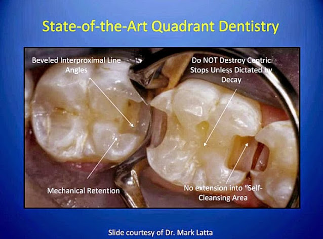 WEBINAR: Class II Restoration - Nick Conte, DDS