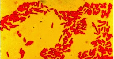 Bakteri Shigella dysenteriae Penyebab Penyakit Disentri - Biologi ...