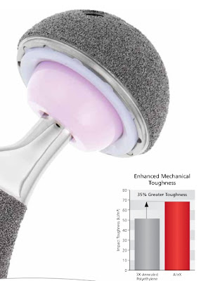 OSSA CARPALIA ©: febrero 2012