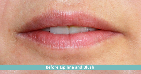 Jan Jordan - Permanent Makeup & Micropigmentation in Surrey: Lip Line ...