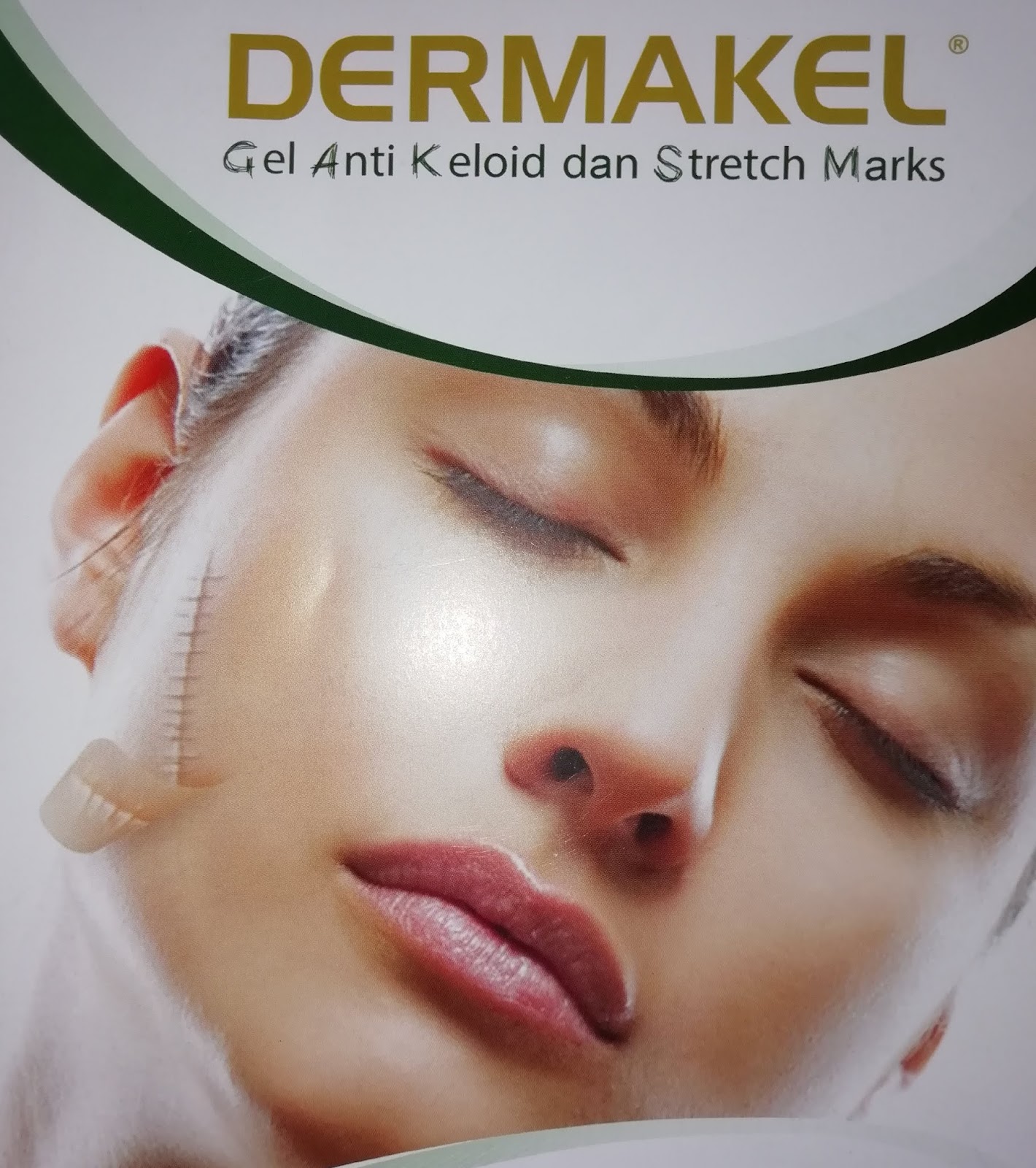 [OBAT] DERMAKEL Anti Keloid dan Stretch Marks - Tempat Belajar