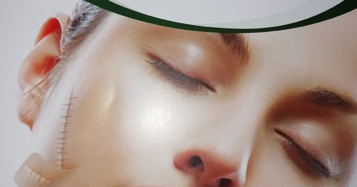 [OBAT] DERMAKEL Anti Keloid dan Stretch Marks - Tempat Belajar