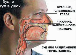 AндерсФакты. : Аллергия на алкоголь