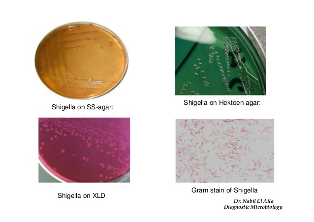 SHIGELLA SPP. - Microbiology Laboratory Turkey