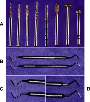 Odontology Student: Prosthodontics: The Metal-Ceramic Crown Preparation ...