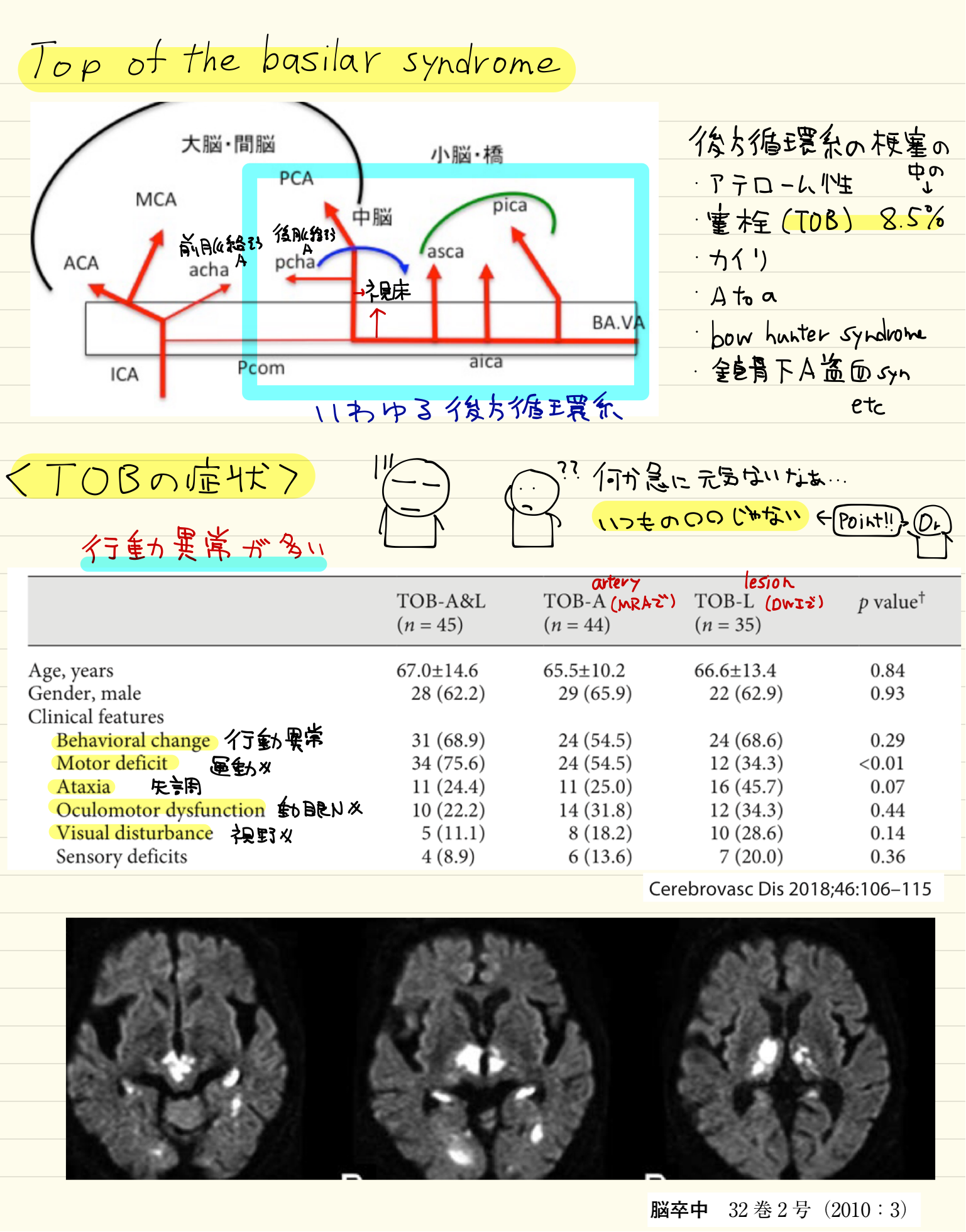 Dr Note〜いつも心に〜: Top of the basilar syndrome 〜一見、脳梗塞に見えない時も〜