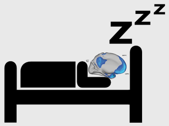 The Neurocritic: The Brain at Rest