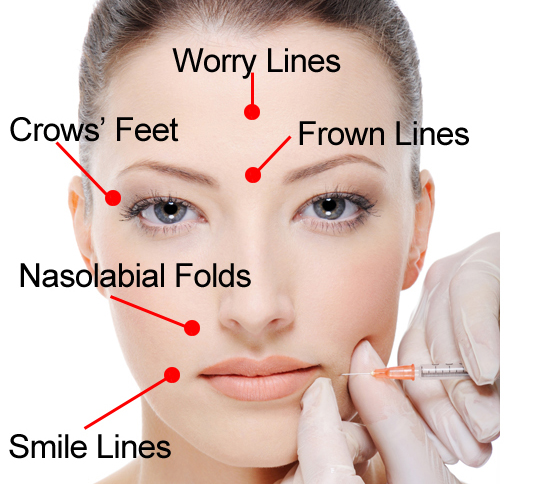 Skin Care Advice Blog: Stay Away From Toxic Injections! is Botox poison?