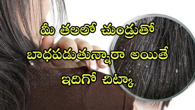చుండ్రు సమస్య నుండి పరిష్కారాలు - Solutions from dandruff problem ...