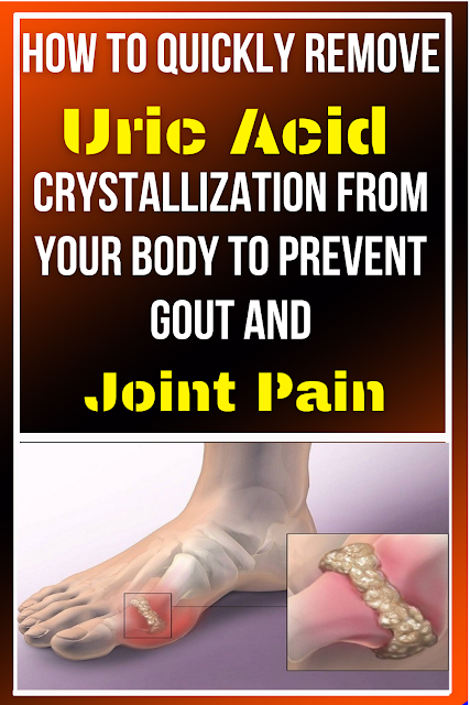 How To Quickly Remove Uric Acid Crystallization From Your Body To ...