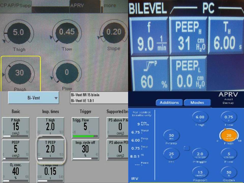 FREMITUS: APRV, BiLevel, BiVent FREE course
