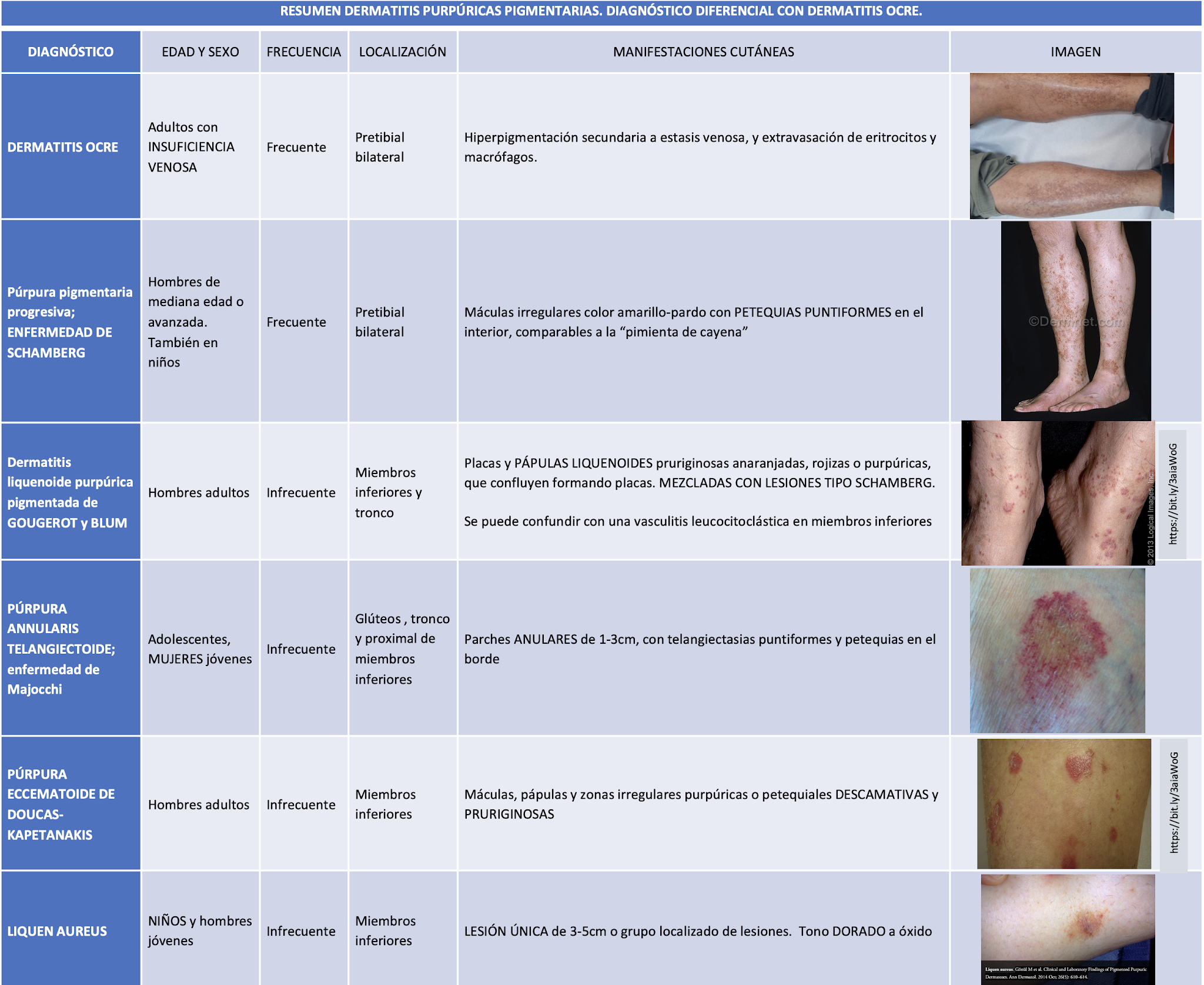 Derma-Docència Castelló: Mire cómo tengo las piernas... DERMATITIS OCRE