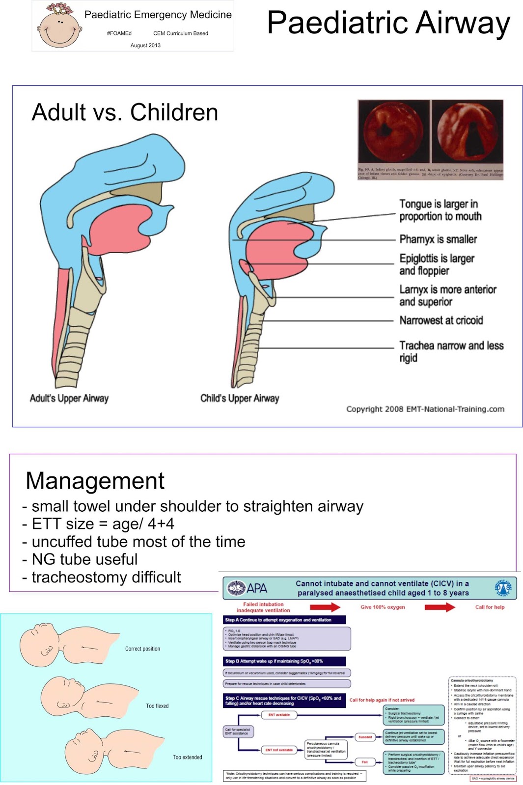 Paediatric Emergency Medicine: Apnoea, stridor and airway and obstruction