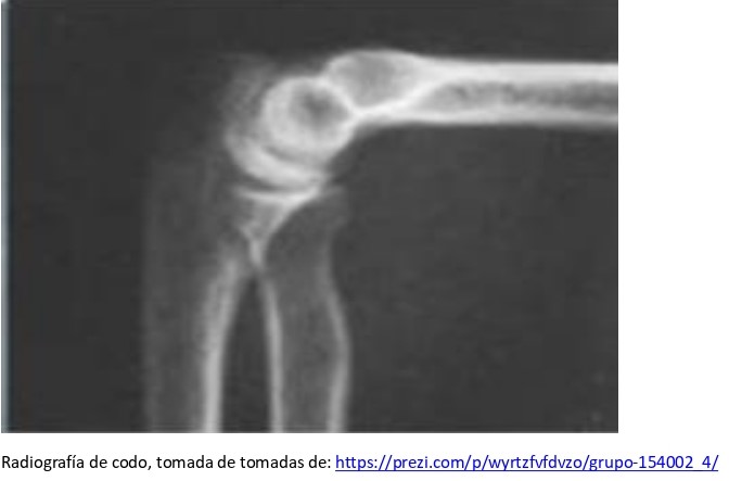 PROTOCOLOS DE LOS ESTUDIOS RADIOLÓGICOS MIEMBROS SUPERIORES