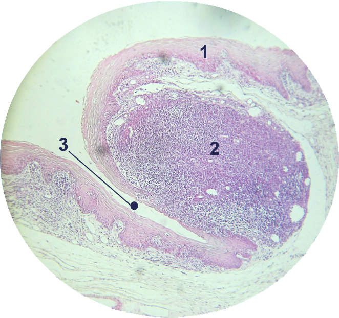 Histologia Oral UFF: Tonsila
