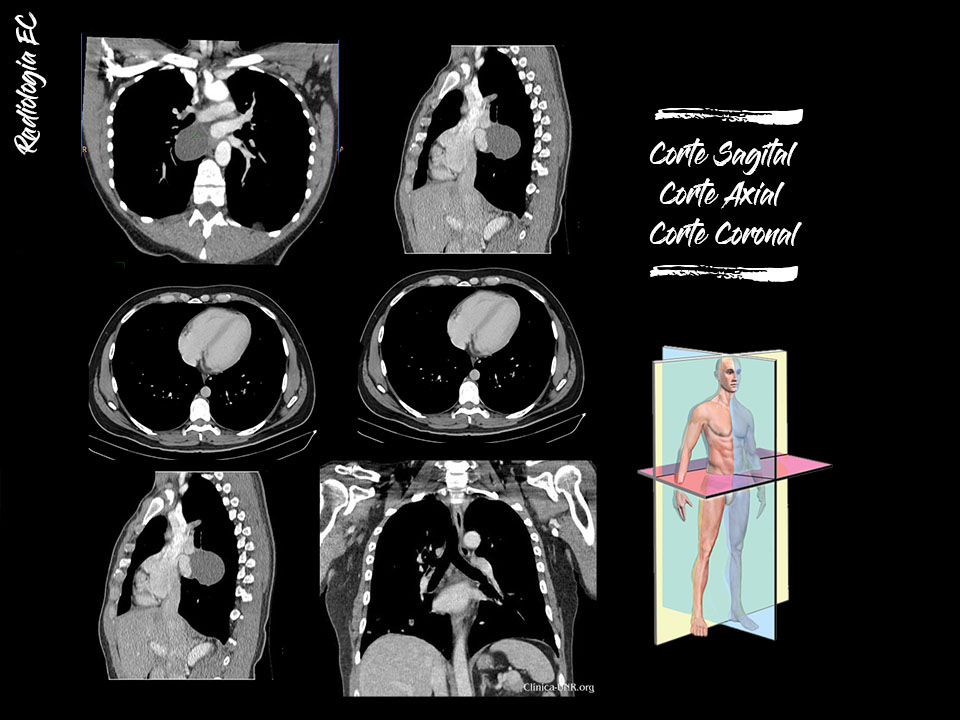 TAC - Haz click en la región de exploración