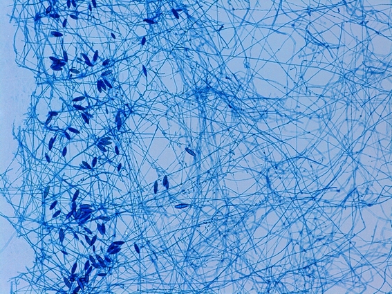 Fun With Microbiology (What's Buggin' You?): Microsporum gypseum