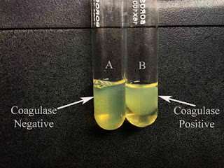 MICROBIOLOGY BLOG FOR STUDENTS (MBLOGSTU): Cultural and Biochemical ...