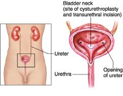 SURGSEMINAR: URINARY BLADDER 3 visualisation