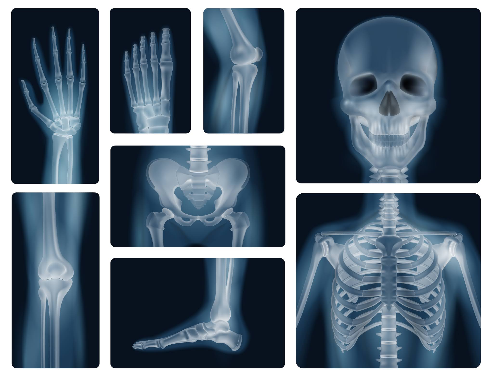 What Is Bone Cancer And What Are Its Types, Causes & Treatments